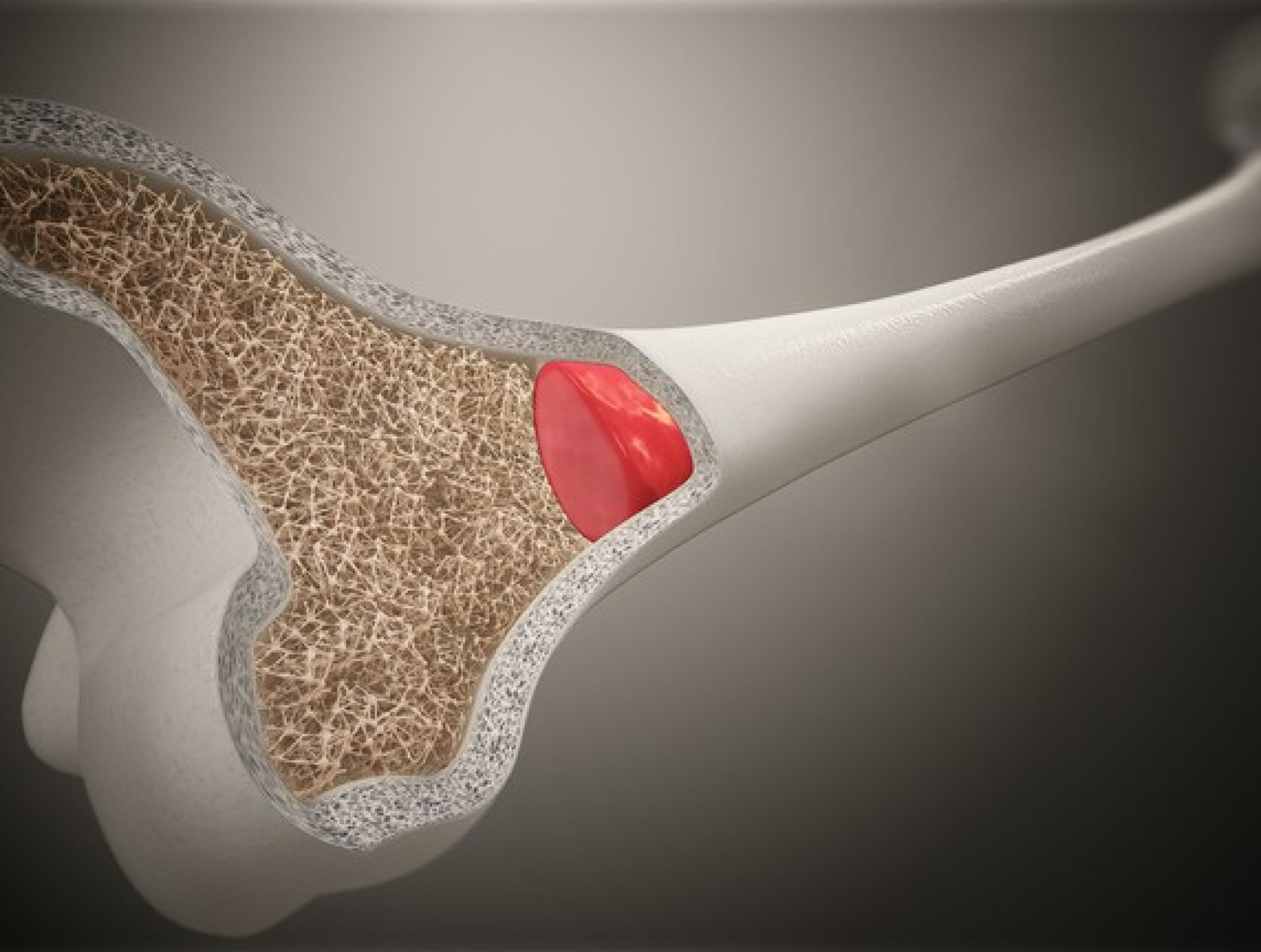 Regenerative Medicine — Bend, OR - High Desert Sports & Spine